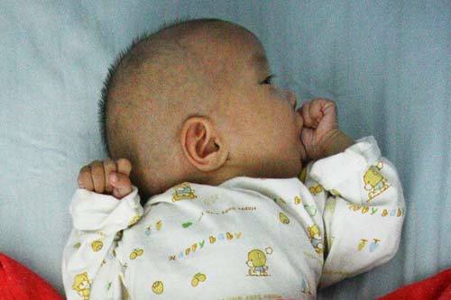 พบเด็กทารก 3 ขาถูกทิ้งในจีน แพทย์รอผ่าตัดขาให้เป็นปกติ