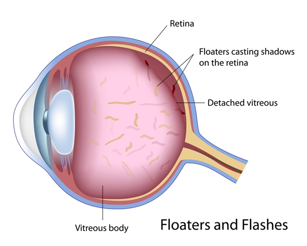 Floater 